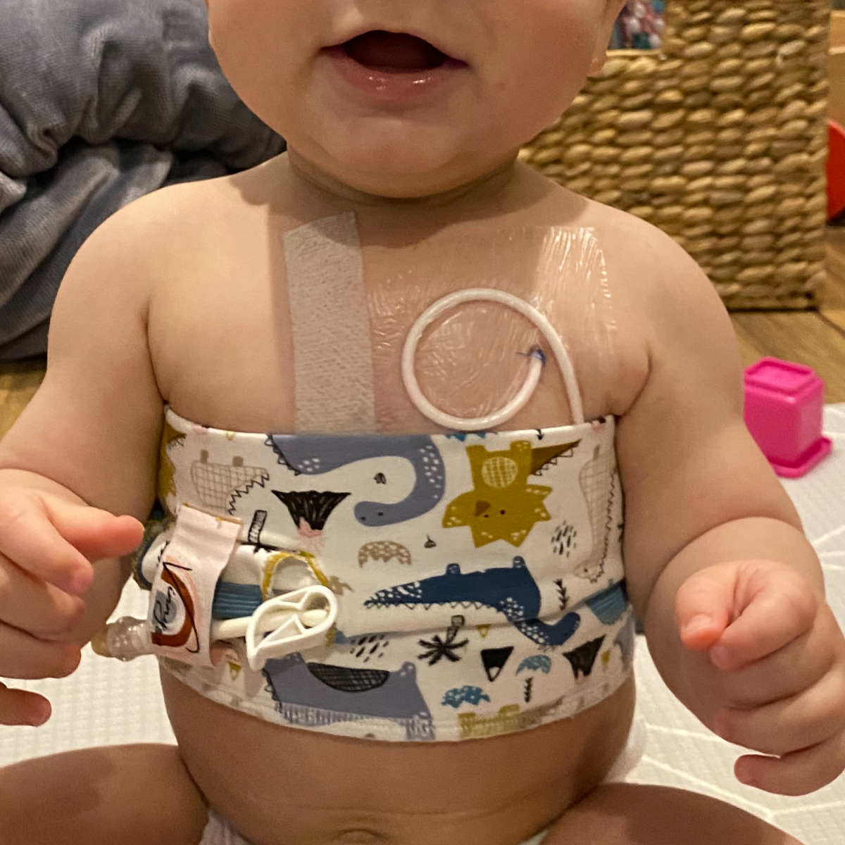 CVC/Hickman Line Wraps – Vinny & Co